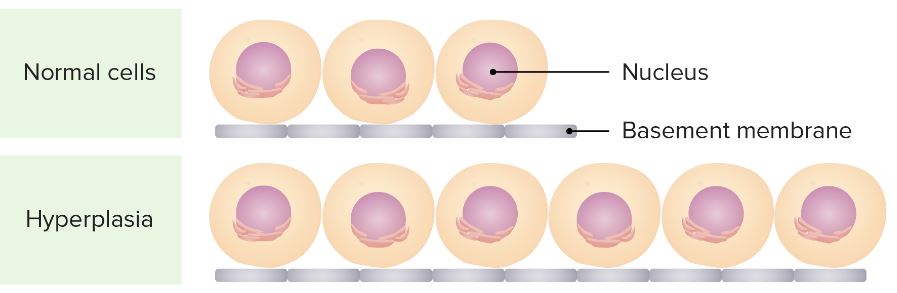 Cellular Changes – Nursing Notes