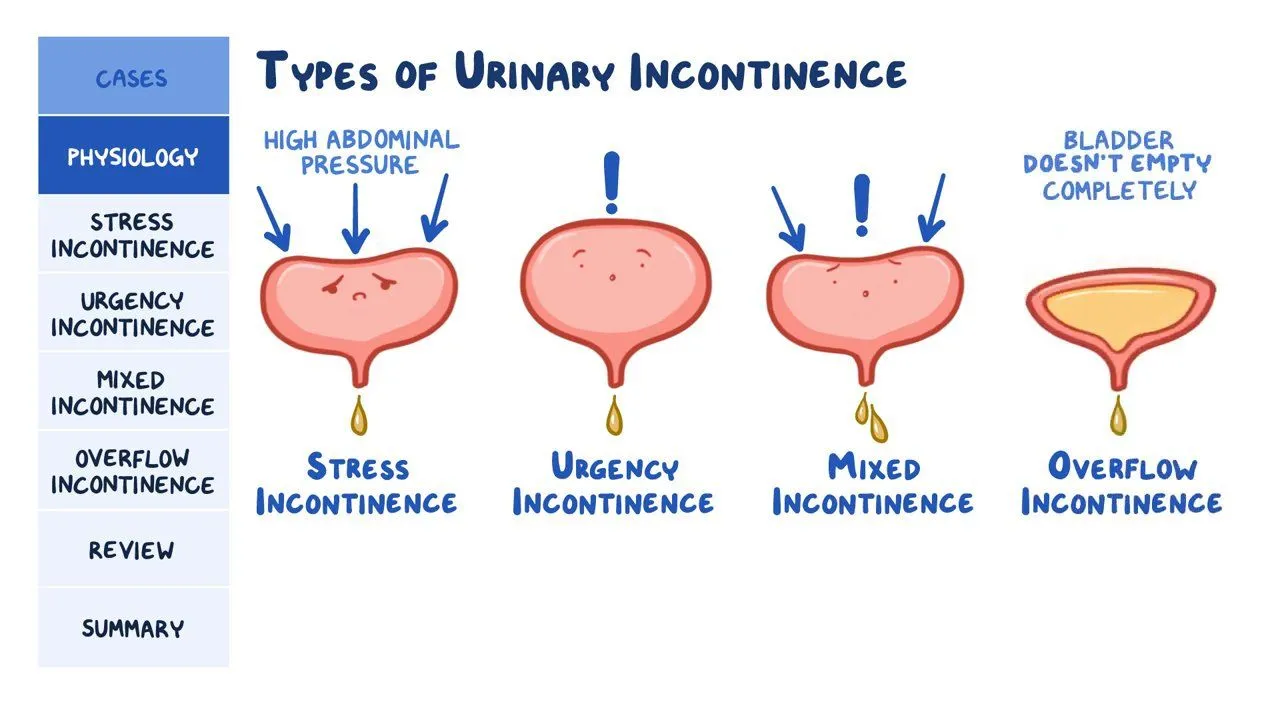 Urinary Incontinence: What You Need to Know – Nursing Notes
